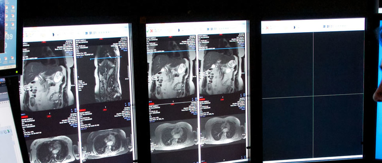 NOC Overview | College of Nursing - The University of Iowa